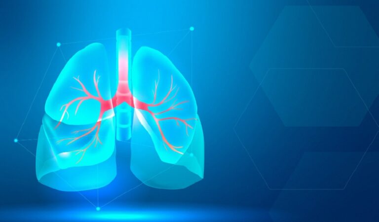 CT imaging used to detect and diagnose lung nodules - Lung Nodule